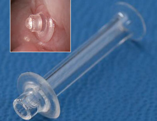 StopLoss™ Jones Tubes - FCI